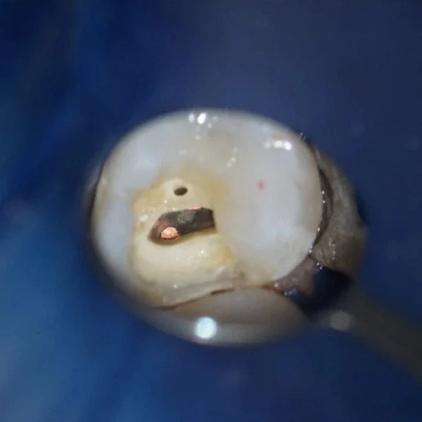 SAPPHIRE HD Dental PHOTOGRAPHY MIRRORS – E3Endo