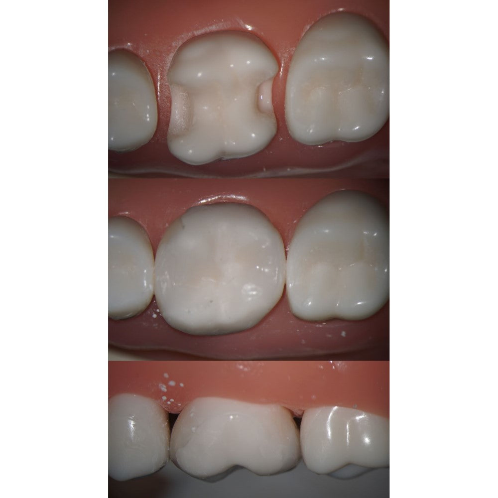 The Bioclear Injection Moulding Technique for Composites - Sydney 8 No ...