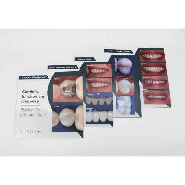 Bioclear Patient Brochures - 10 Pack – E3Endo